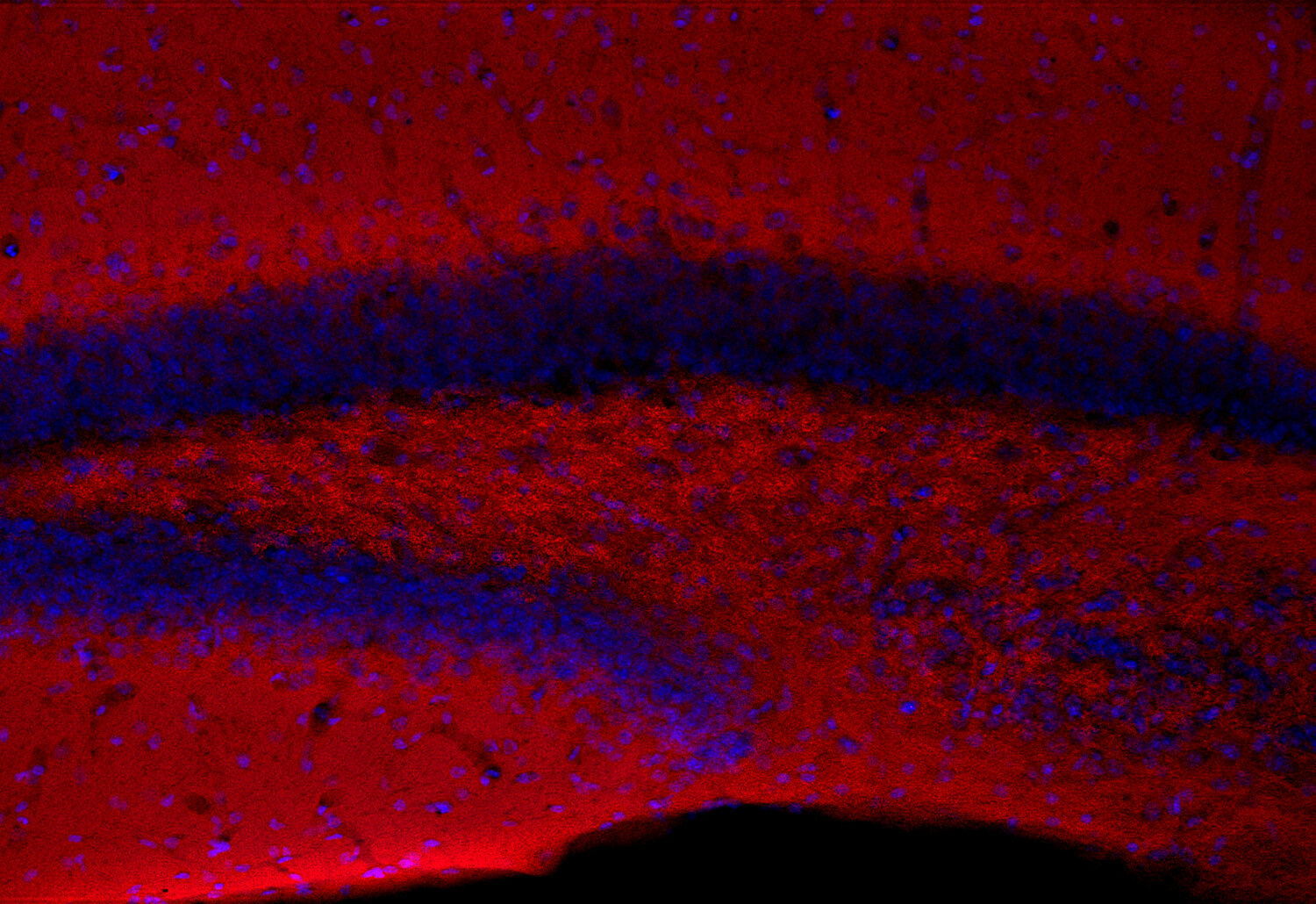 Synaptic Systems - PSD95